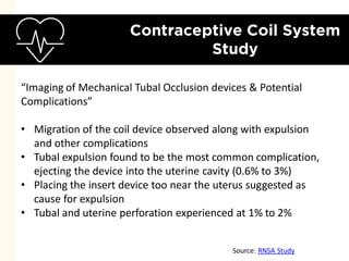 Essure Insert Complications: See The Data Prompting Lawsuit ...