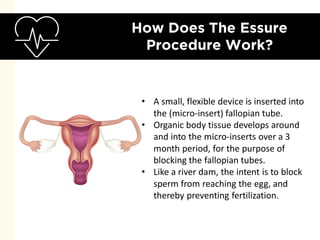 Essure Insert Complications: See The Data Prompting Lawsuit ...