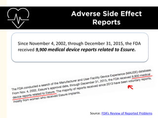 Essure Insert Complications: See The Data Prompting Lawsuit ...