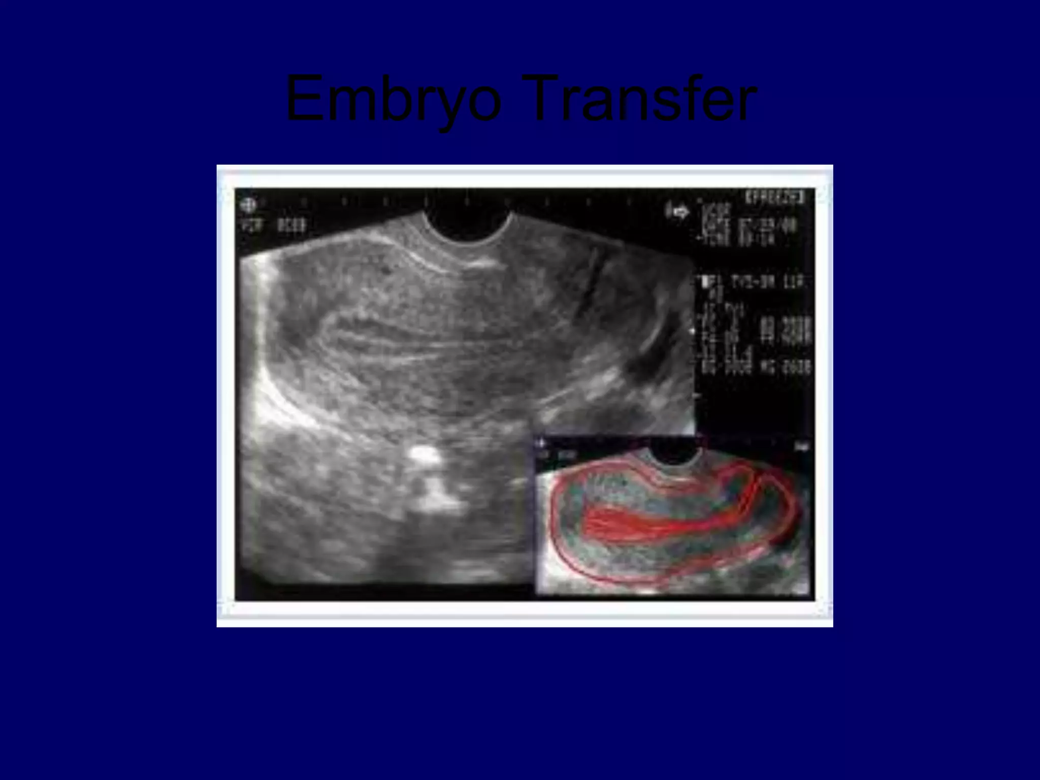 How to establish an ivf center | PPTX