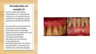 Estadificación y clasificación de la periodontitis.pptx