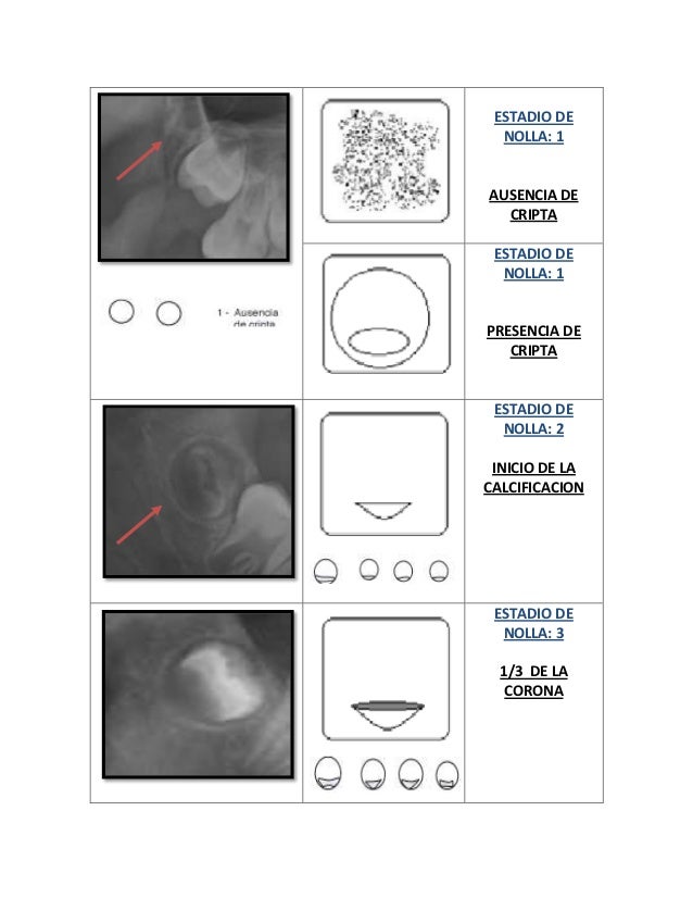 Estadios de nolla[1]