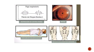 Estados de coma y trastornos de conciencia.pptx