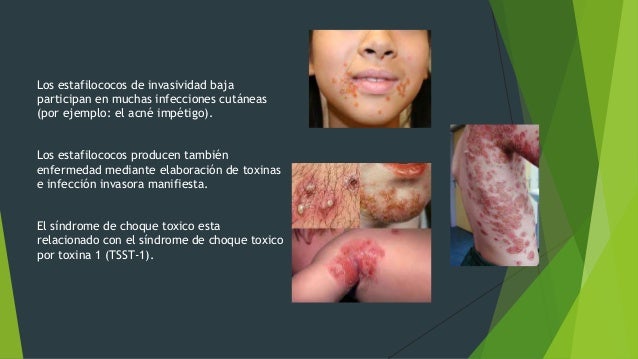 Estafilococos