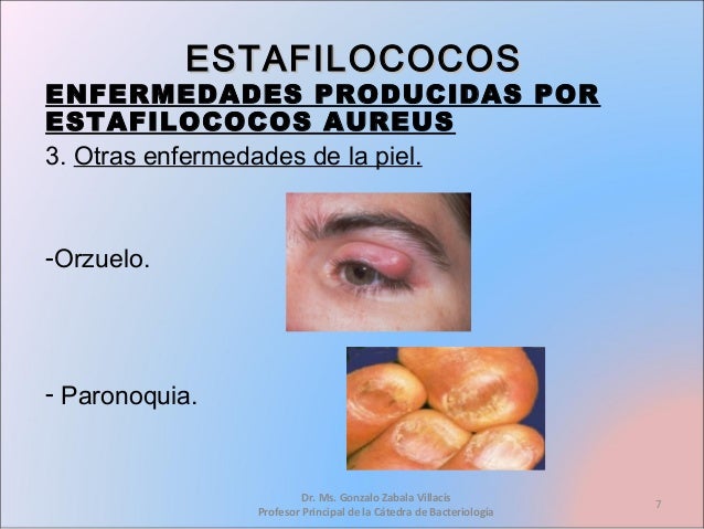 Estafilococos