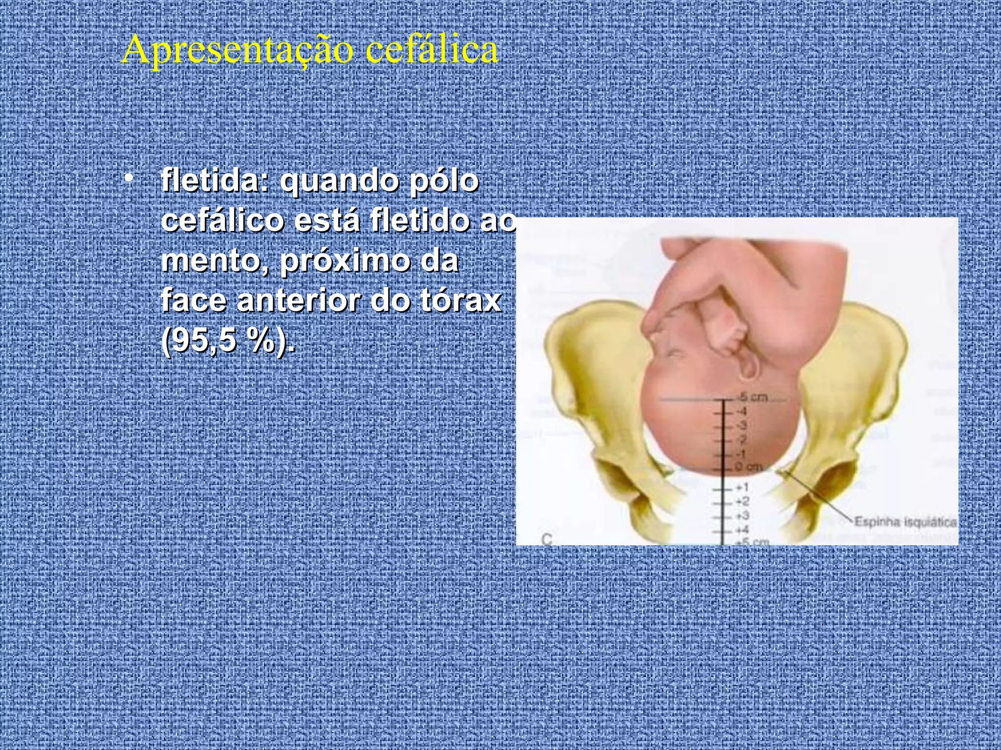 Estatica fetal e relações útero fetais | PPT