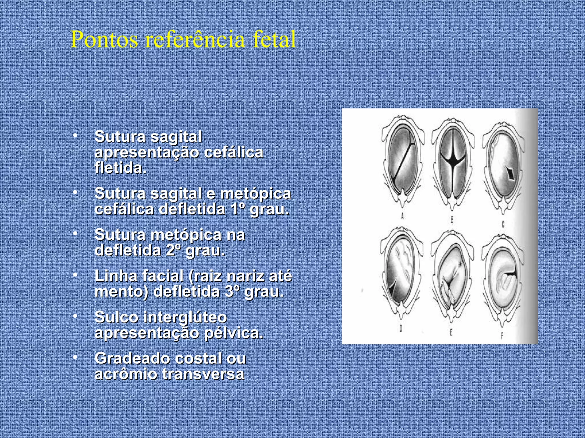 Estatica fetal e relações útero fetais | PPT