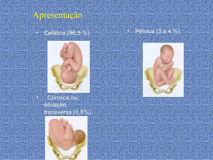 Estatica fetal e relações útero fetais