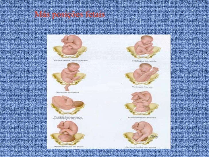 Estatica fetal e relações útero fetais
