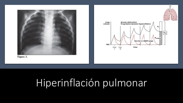 Estatus Asmatico 2017