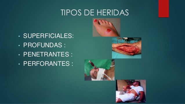 Herridas Y Hemorragias