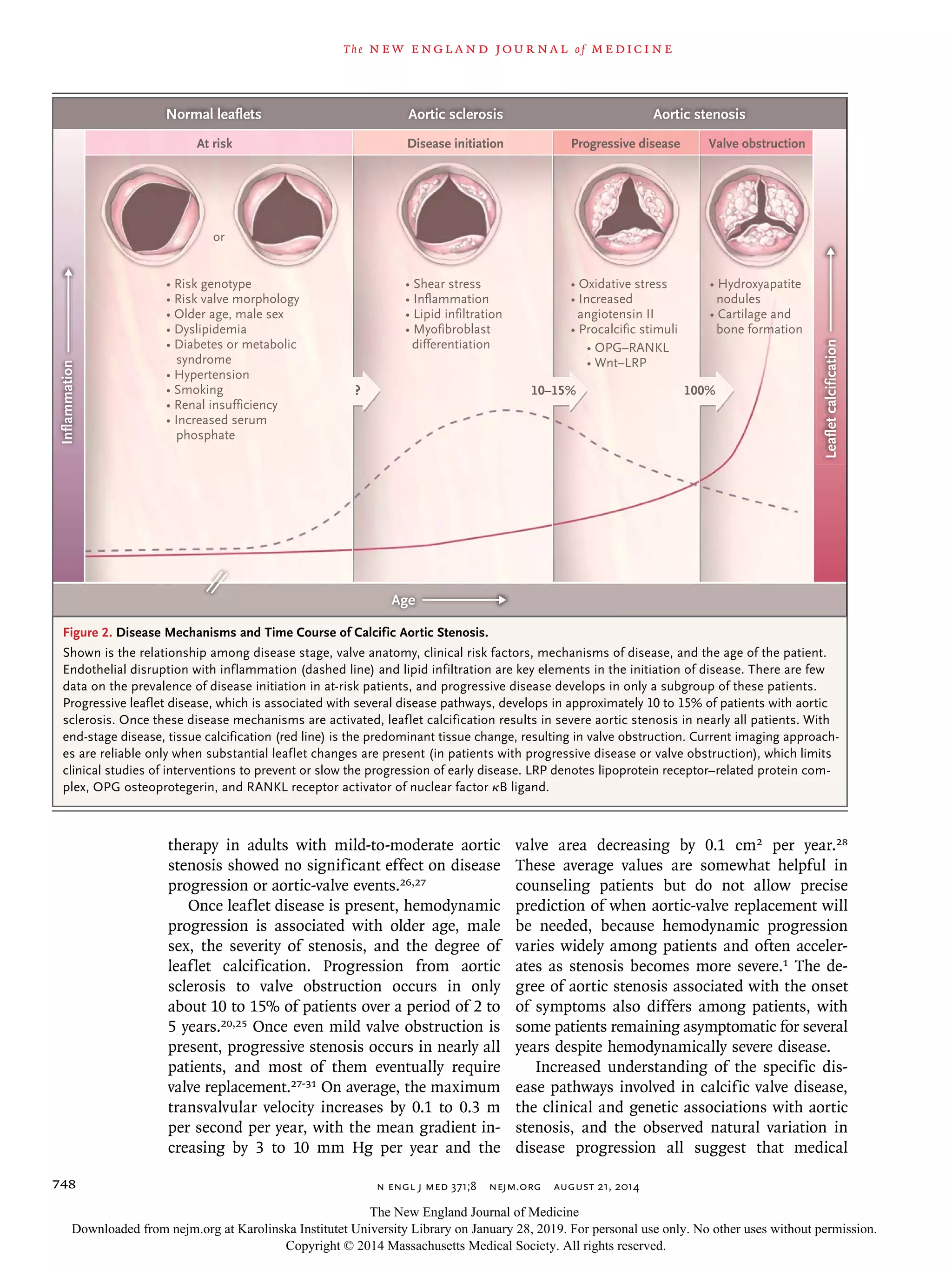 Estenosis aortica.pdf