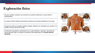 ESTENOSIS E INSUFICIENCIA AORTICA.pptx