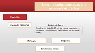 Estenosis esofágica y Cáncer de Esófago | PPTX