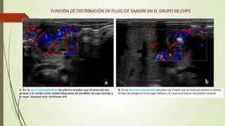 ESTENOSIS HIPERTROFICA DEL PILORO Y ECOGRAFIA.pptx