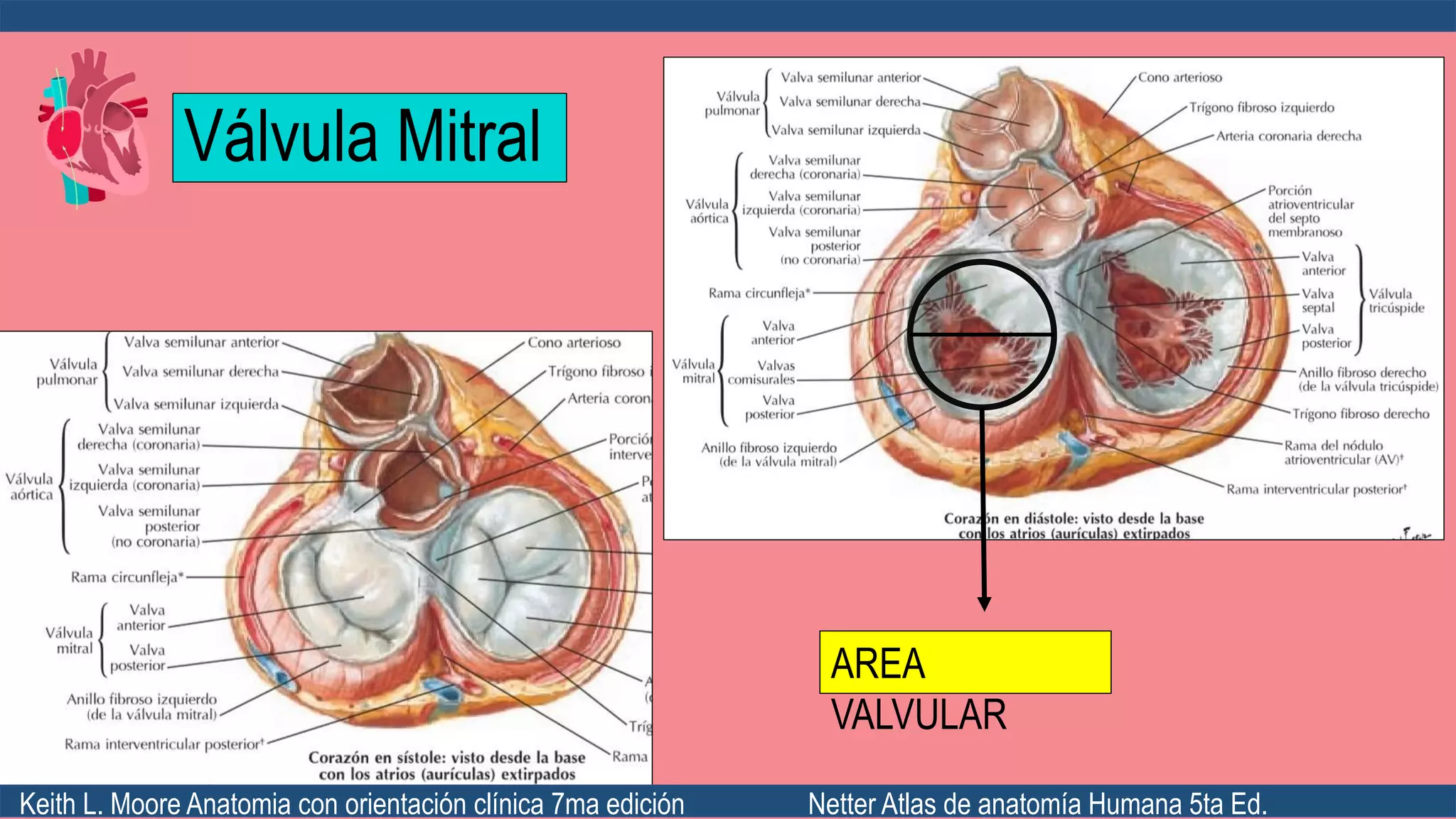 Estenosis Mitral Pptx