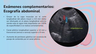 Estenosis pilórica.pptx