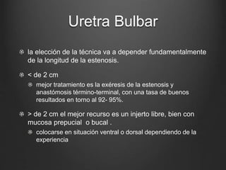 Estenosis uretral | PPTX