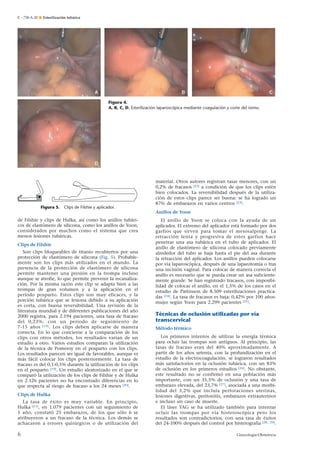 Esterilizacion tubaria | PDF