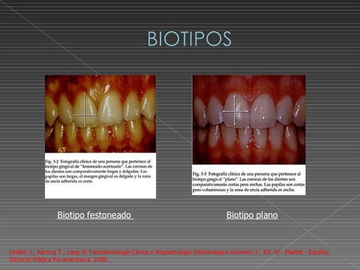 Estetica del periodonto 1