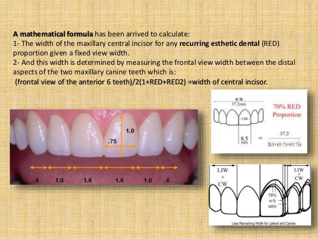 Esthetic considerations.