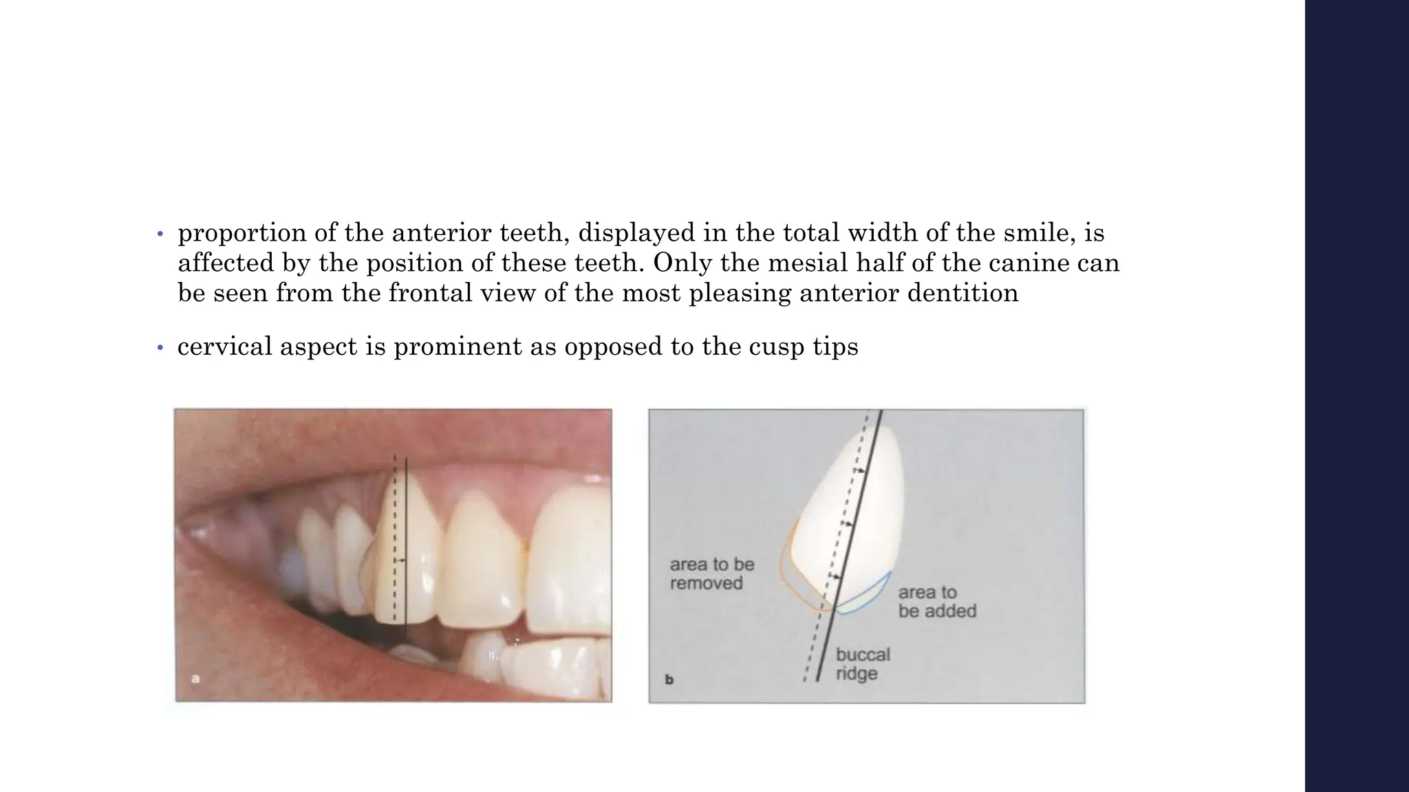 esthetic considerations in fixed partial dentures.pptx
