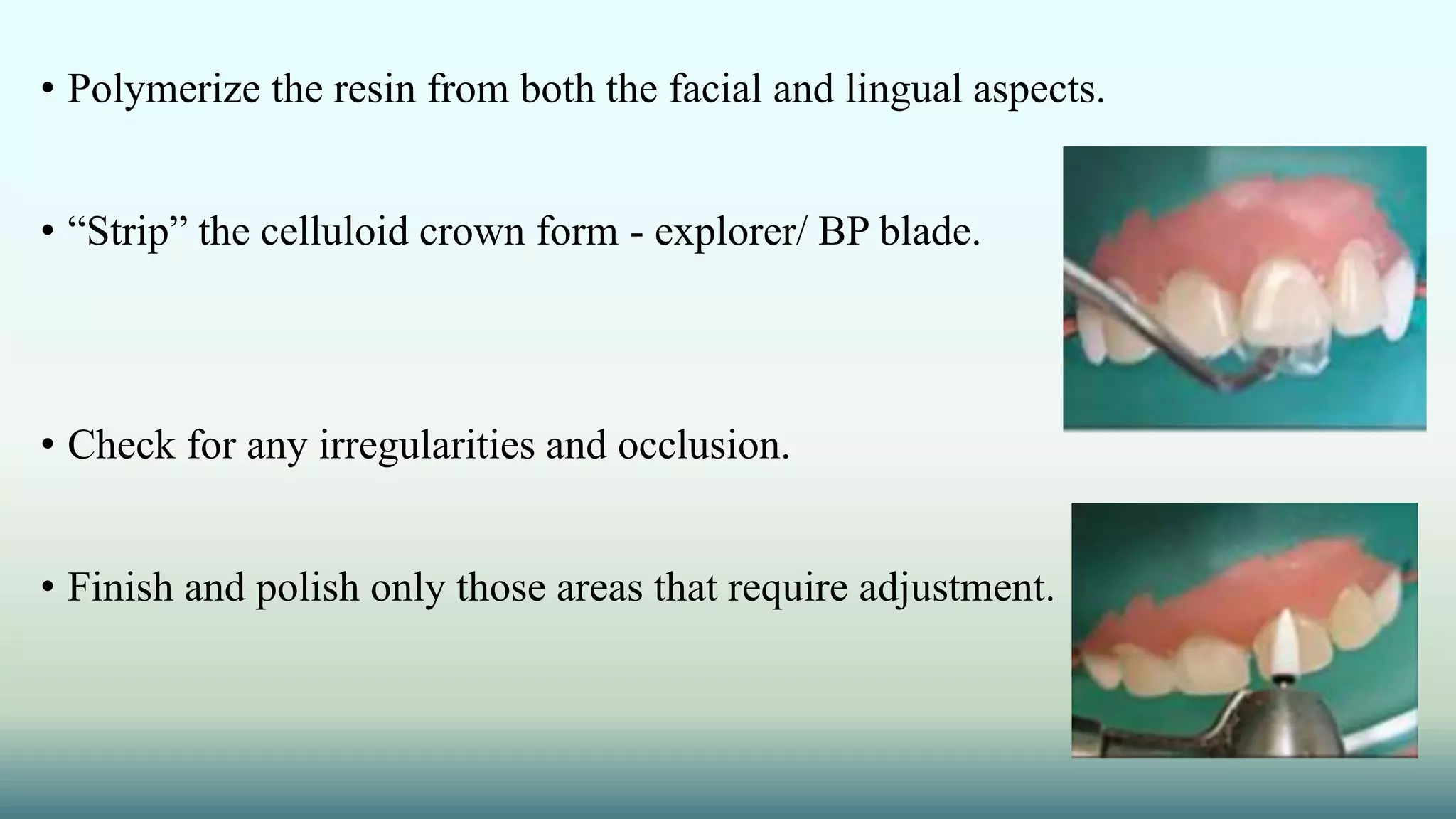 Esthetic crowns in pediatric dentistry.pptx