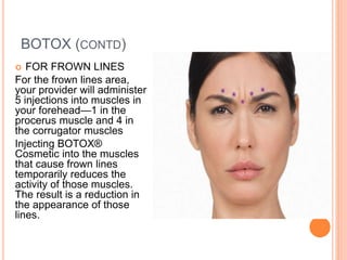 Esthetic dentistry A Glimpse | PPTX