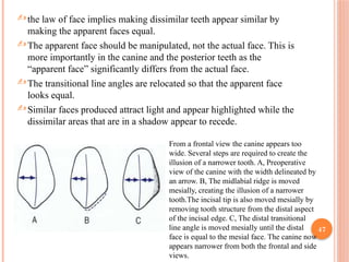 Esthetic dentistry and smile designing in conservative dentistry | PPTX