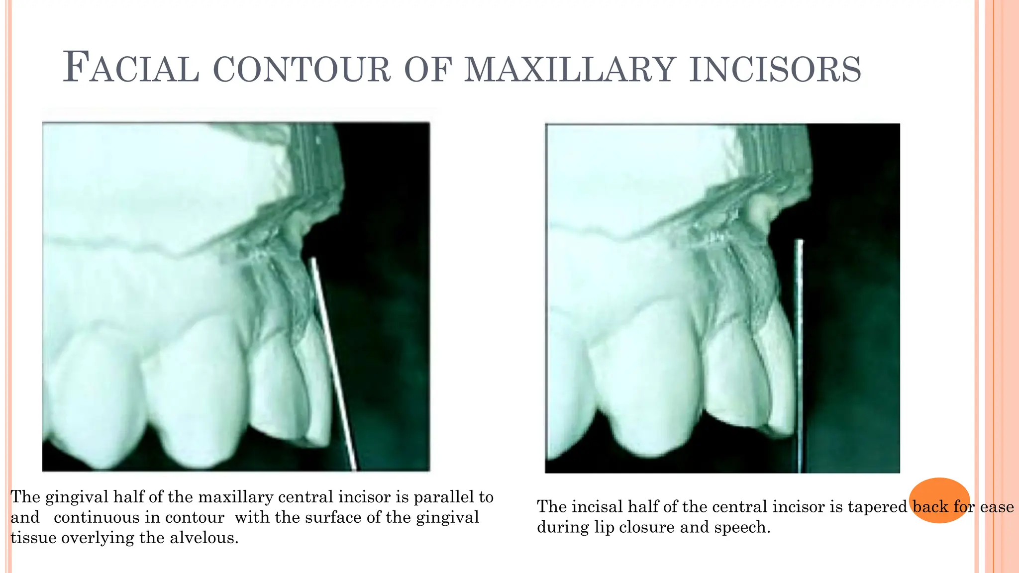 esthetic diagnosis and treatment planning.pptx