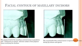 esthetic diagnosis and treatment planning.pptx