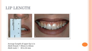 esthetic diagnosis and treatment planning.pptx