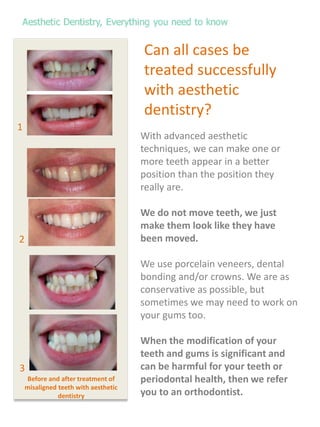 Aesthetic Dentistry, Everything you need to know | PDF