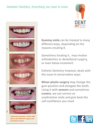 Aesthetic Dentistry Everything You Need To Know Pdf