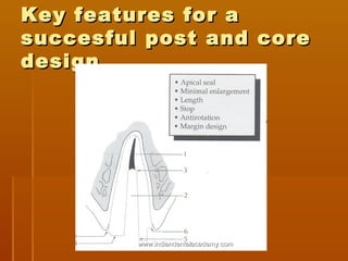 Esthetic post systems /certified fixed orthodontic courses by Indian ...