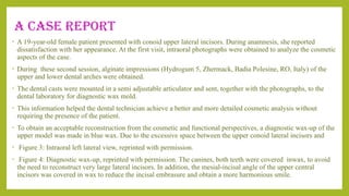 Esthetic Rehabilitation of the Smile with No-Prep Porcelain.pptx