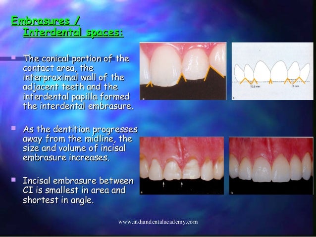 Esthetics / orthodontics courses in india