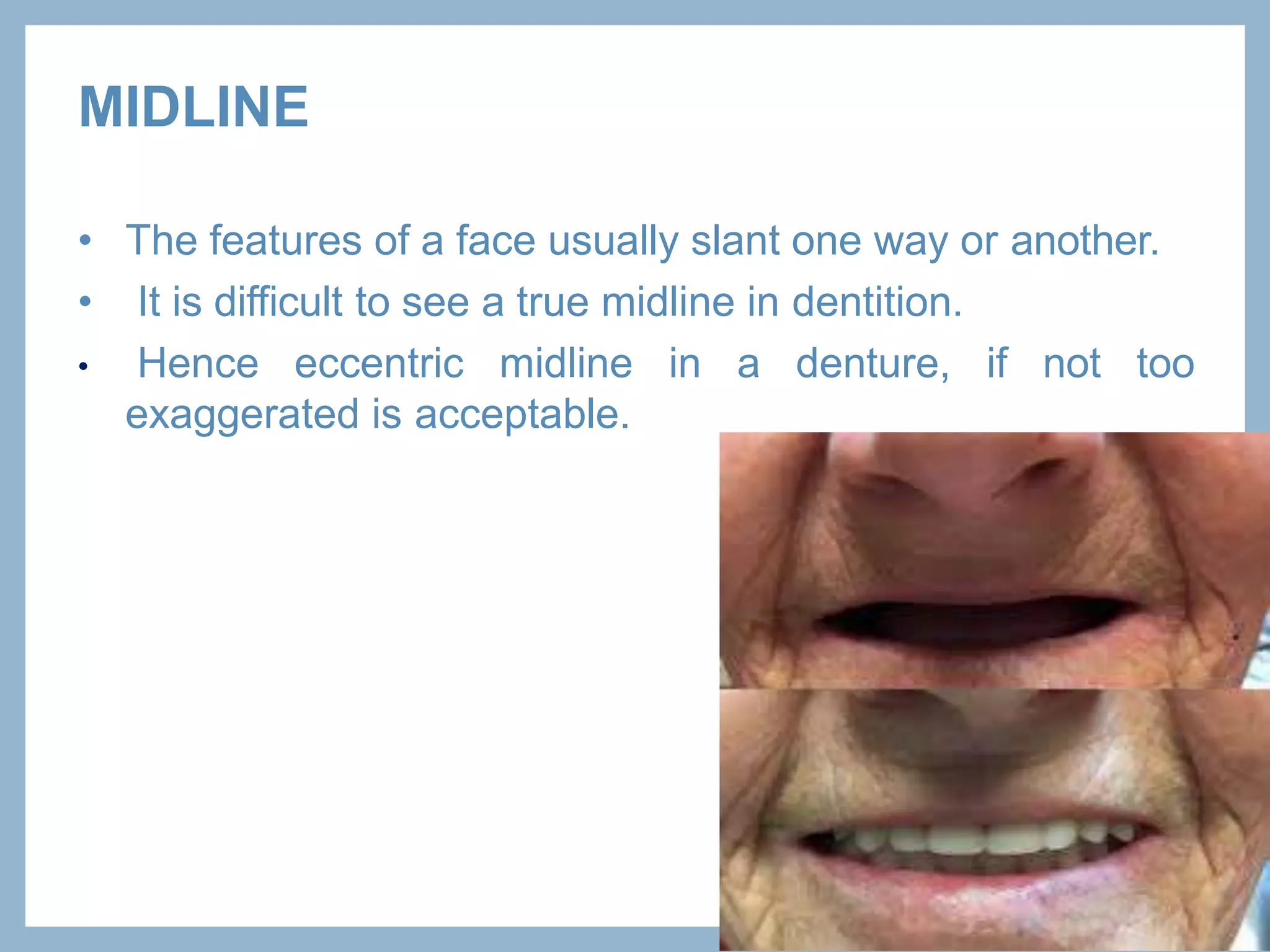 Esthetics in complete dentur.pptx