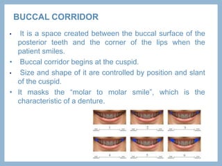 Esthetics in complete dentur.pptx