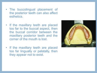 Esthetics in complete dentur.pptx