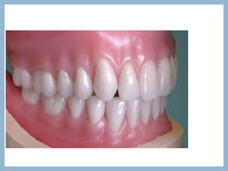 Esthetics in complete dentur.pptx