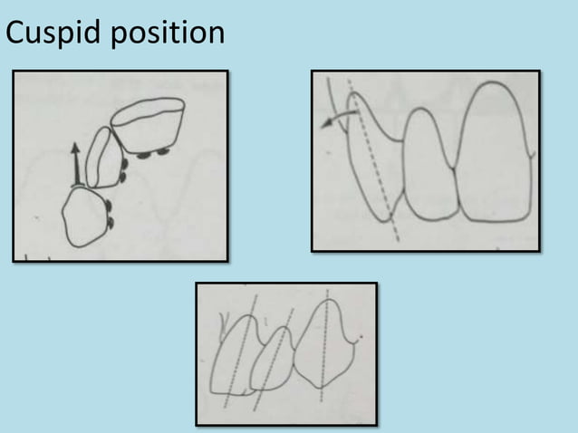 Esthetics in complete denture | PPTX