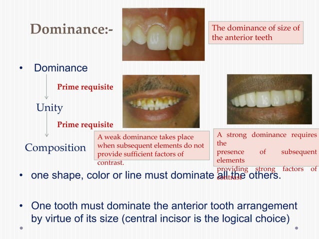 Esthetics in complete denture | PPTX | Dental Health | Diseases and ...