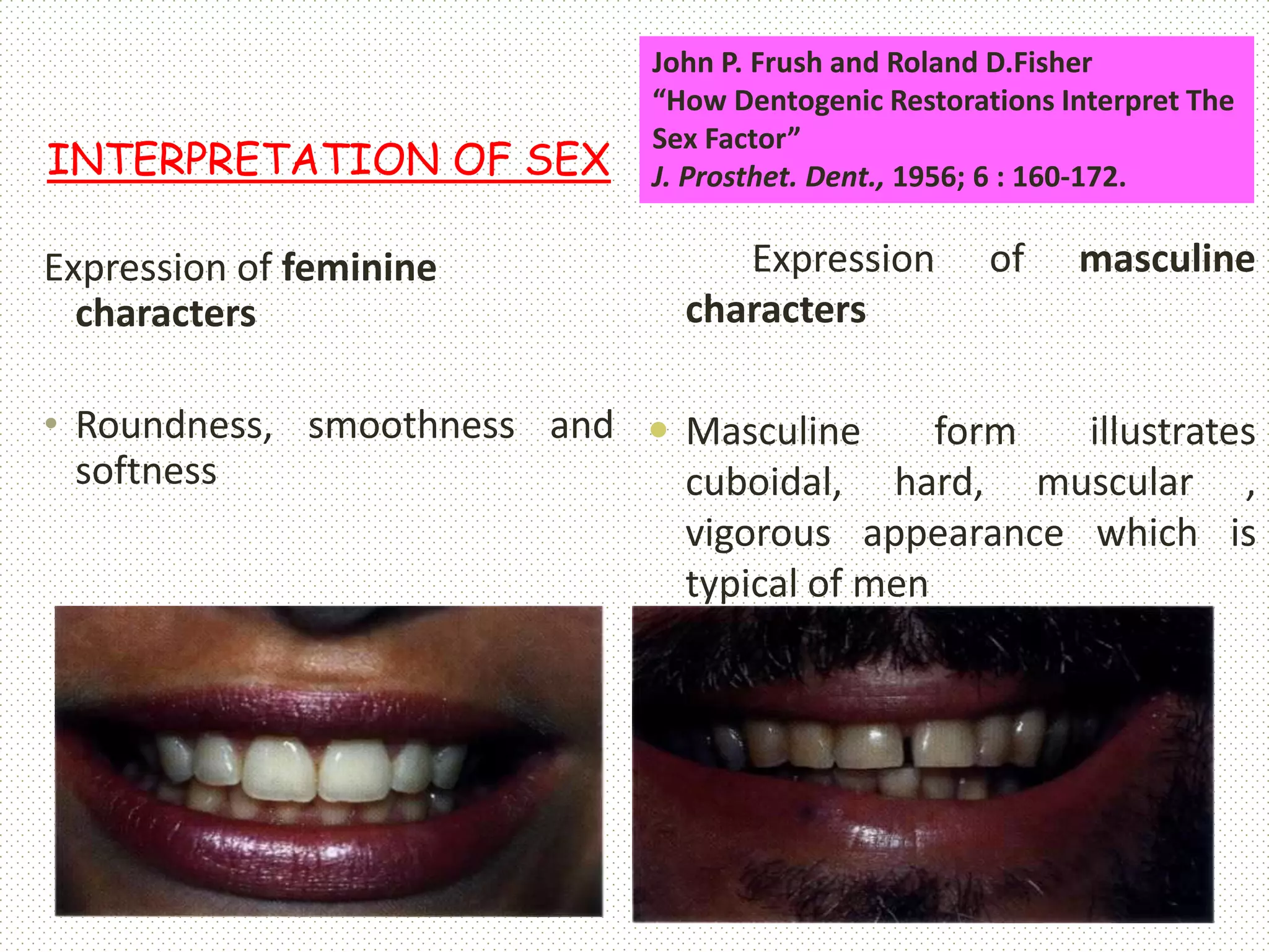 Esthetics in complete dentures dentogenic concept | PPTX