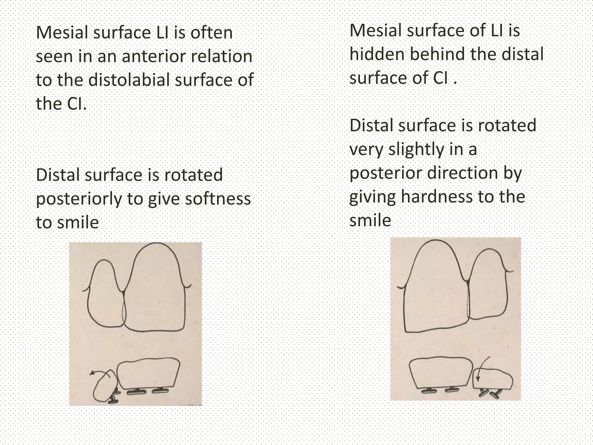 Esthetics in complete dentures dentogenic concept | PPTX