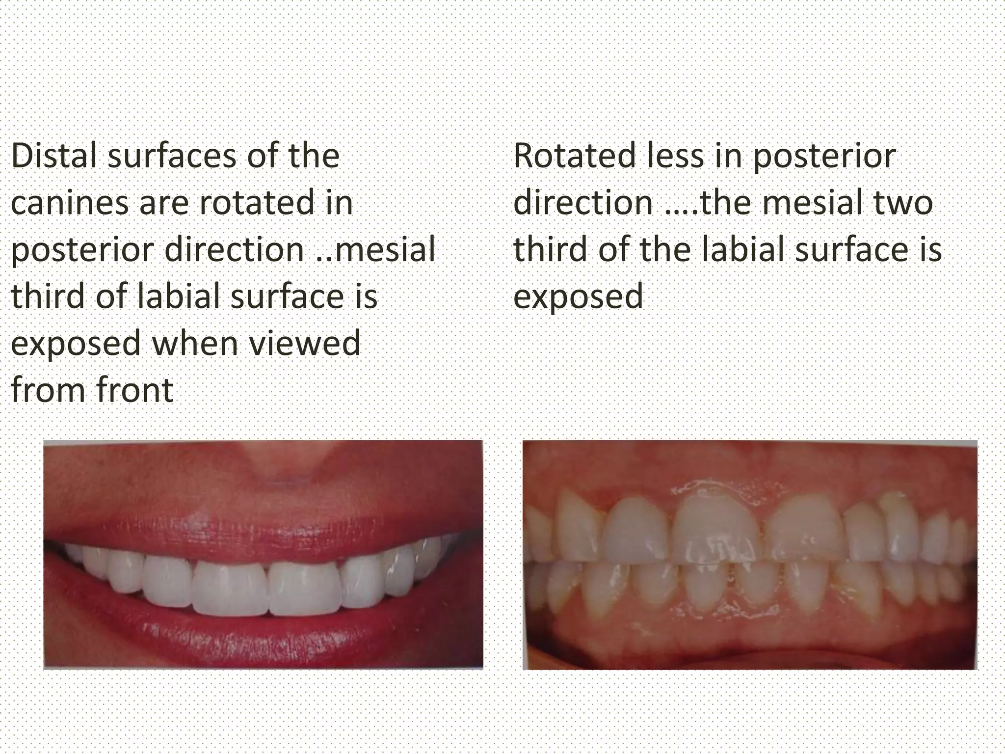 Esthetics in complete dentures dentogenic concept | PPTX