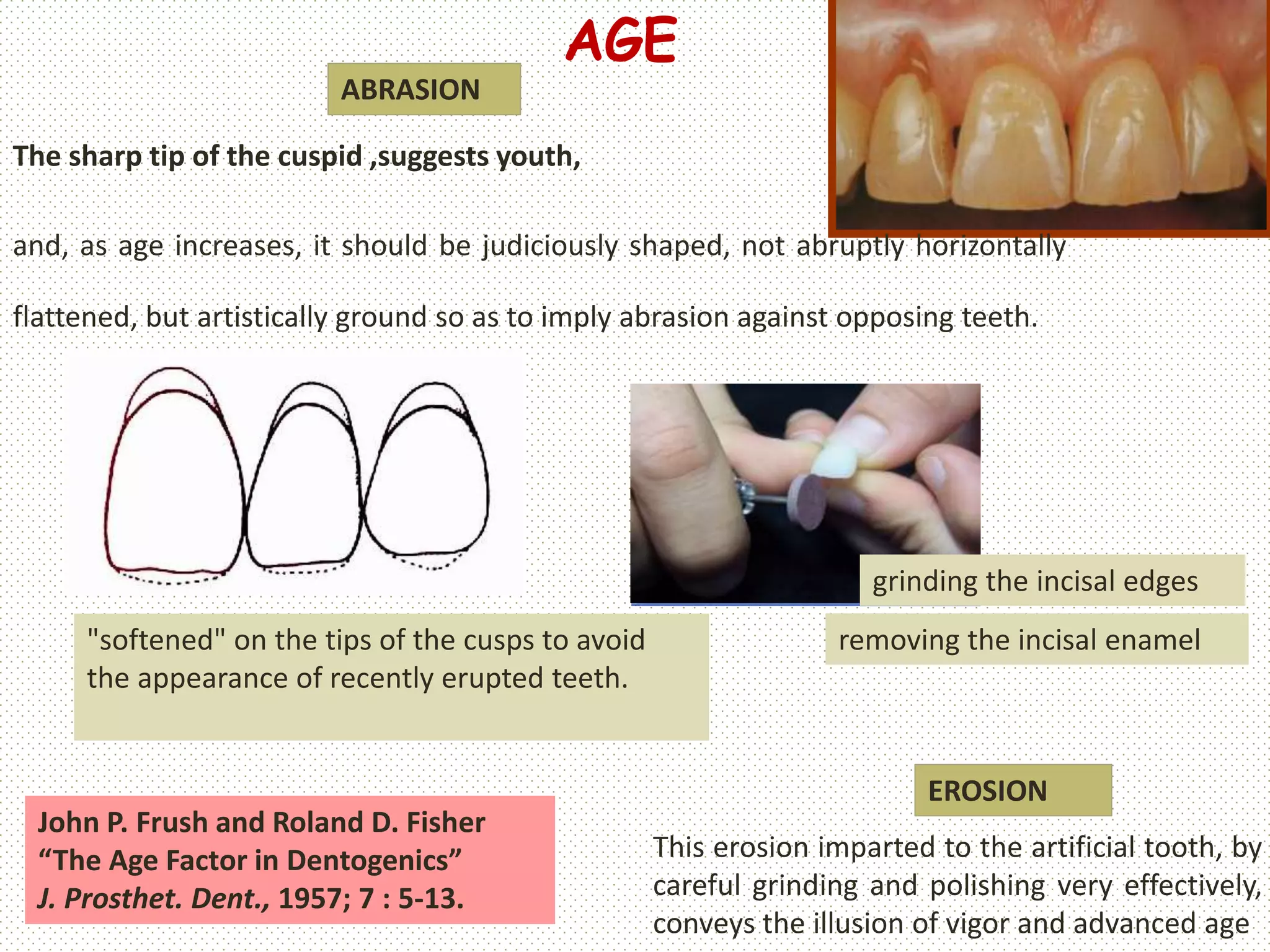 Esthetics in complete dentures dentogenic concept | PPTX | Dental ...