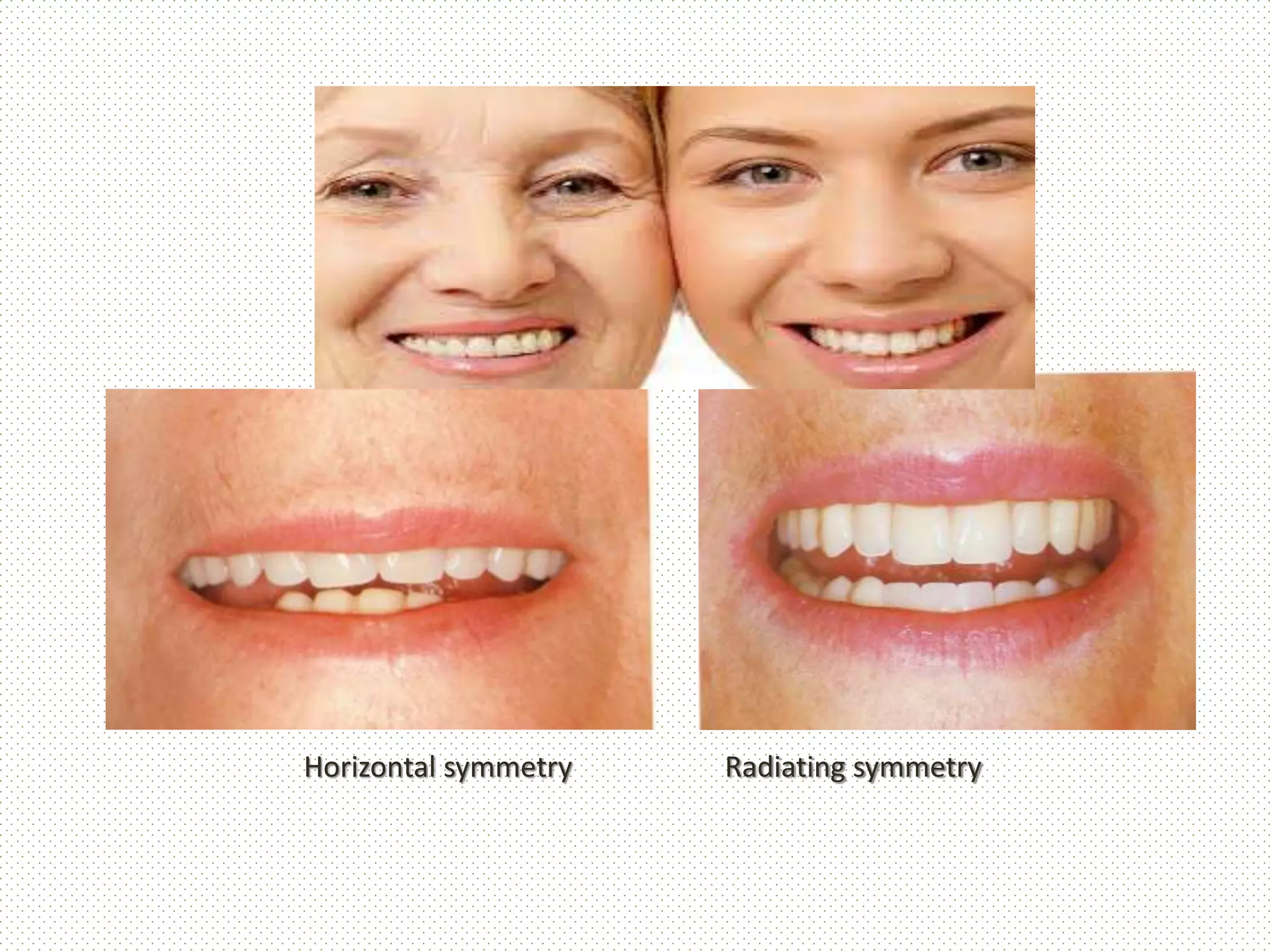 Esthetics in complete dentures dentogenic concept | PPTX