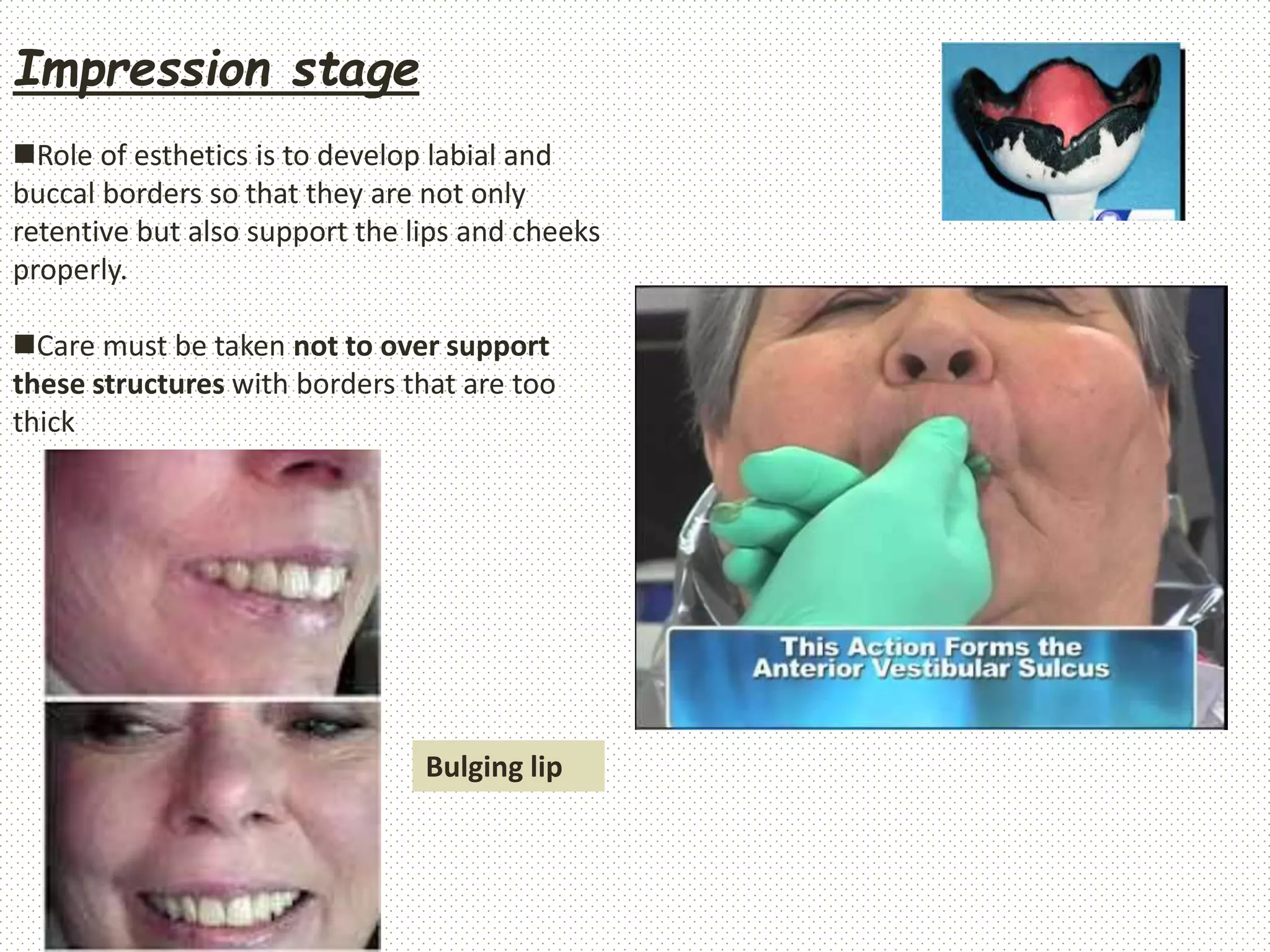 Esthetics in complete dentures dentogenic concept | PPTX