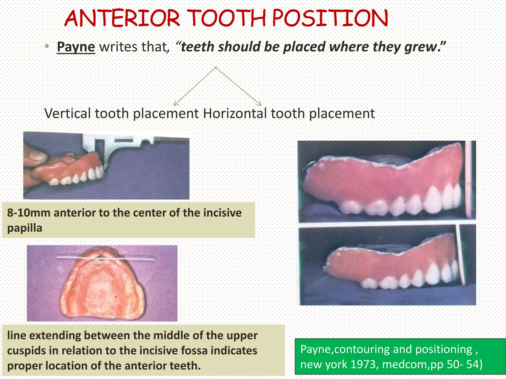 Esthetics in complete dentures dentogenic concept | PPTX | Dental ...